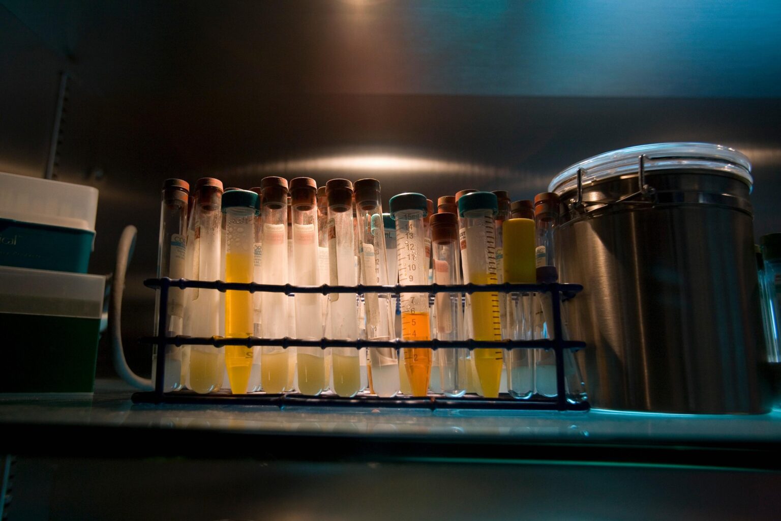 What is the function of a urine analyzer? - ivdsolution.com