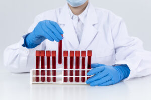 Blood Analyzers: Overview, Functions, Types, and Uses - ivdsolution.com