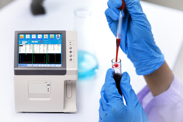Blood Analyzers: Overview, Functions, Types, and Uses - ivdsolution.com