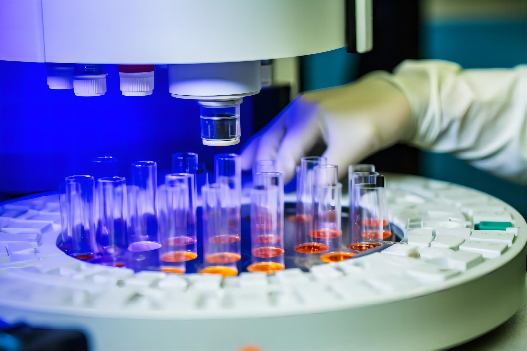 Biochemical Analyzers: Overview, Functions, Types, And Uses - ivdsolution.com