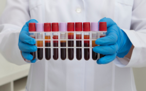 Electrolyte Analyzers: Definition, Functions, Classification, and ...